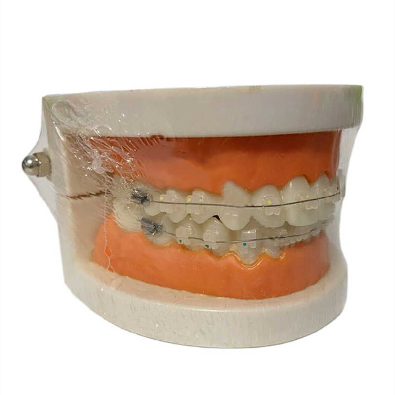 Dental All Ceramic Brackets Study Model Retainer Clear Bracket ...