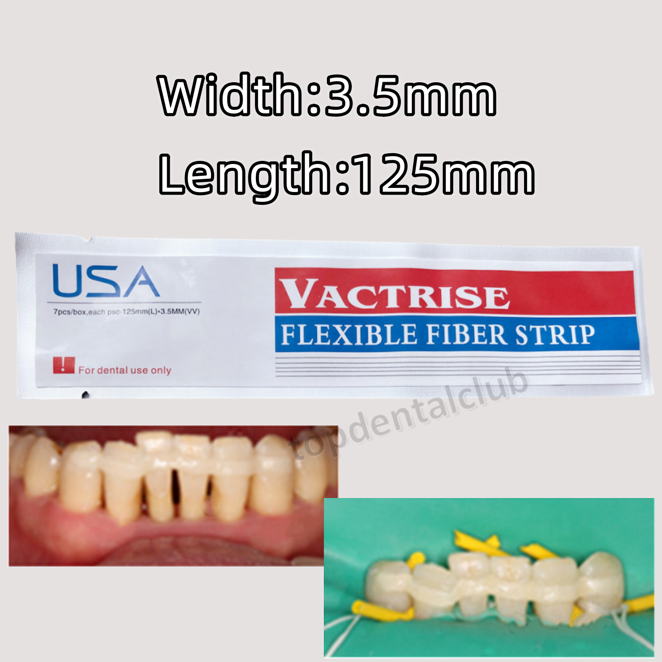 Dental Glass Fiber Splint Retainer Strip Light Cure Composite Resin ...