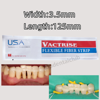 Dental Glass Fiber Splint Retainer Strip Light Cure Composite Resin ...