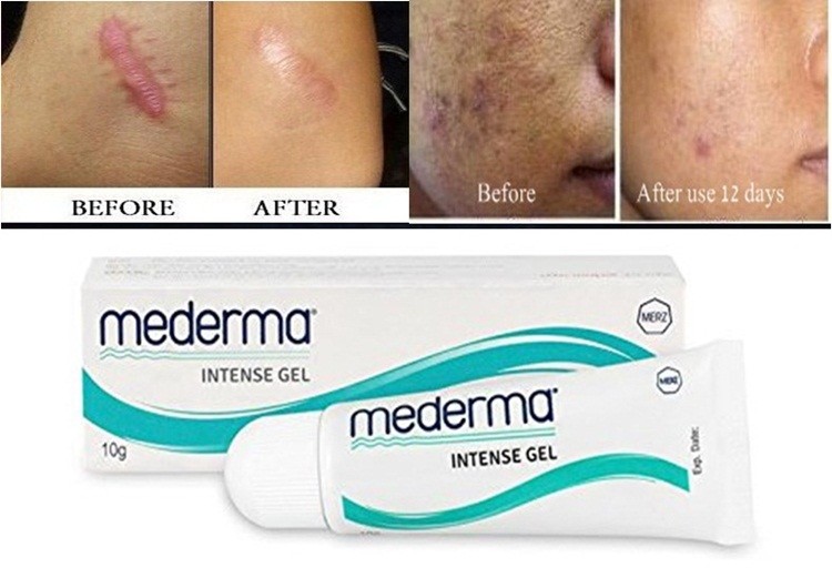 Cicatrici Da Acne Prima E Dopo Mederma Terapia Cicatrici Bi One