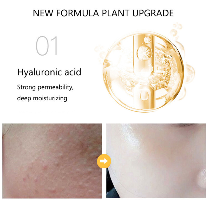 Nicotinamide Liquid 24K Gold Anti Aging Moisturizer with Hyaluronic ...