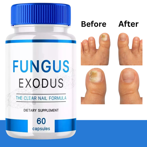 Fungus Exodus Pills to Combat Toenail Fungus and Nail Health 60 ...
