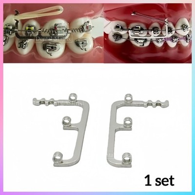Dental Orthodontic Appliance Molar Pusher Distalizer Lingual Brackets ...