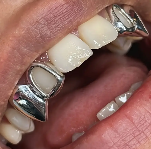 Custom Fit Silver Upper Top Teeth Double Open Face Vampire Fangs Grillz ...