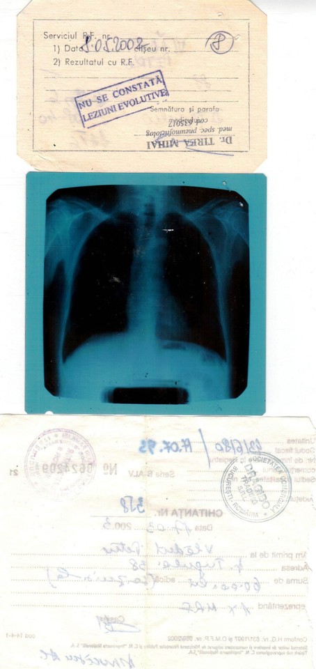 Romania, 2002, Vintage Medical Radiographic / X-RAY File | eBay