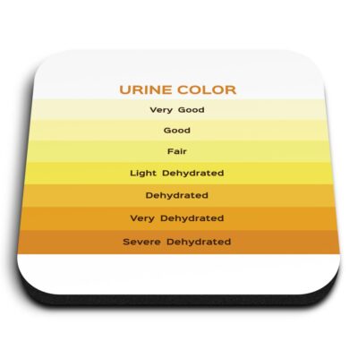 1x Square Fridge MDF Magnet Urine Color Yellow Orange #60547 | eBay