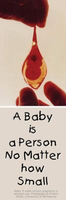 A Baby is a Person Pro-Life Bookmark (Pack of 100) | eBay