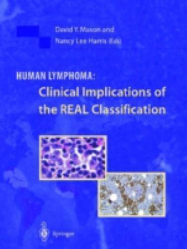 Human Lymphoma : Clinical Implications of the Real Classification by ...