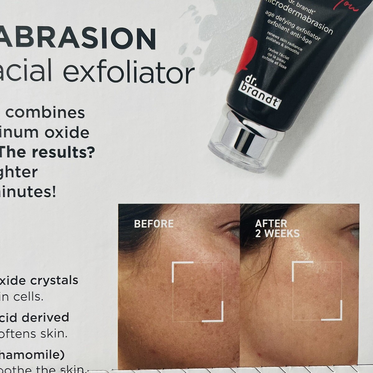 Dr Brandt Microdermabrasion Skin Exfoliant Before And After Best Sale ...