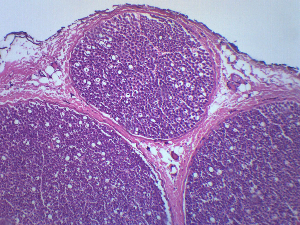 Peripheral Nerve Slide