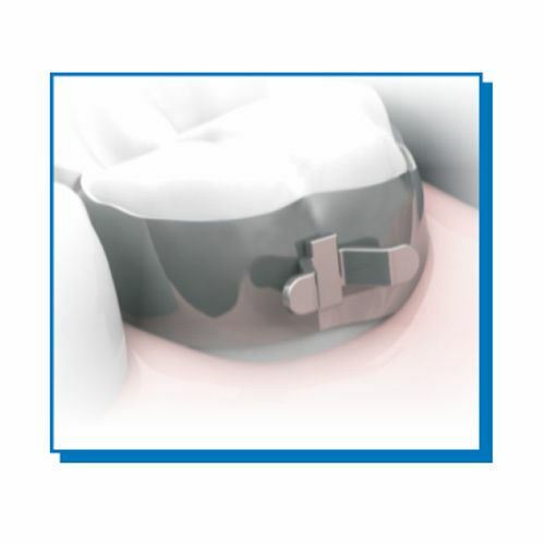 Dental Orthodontic Bondable Welding Lingual Cleats Wings Hook Welding ...