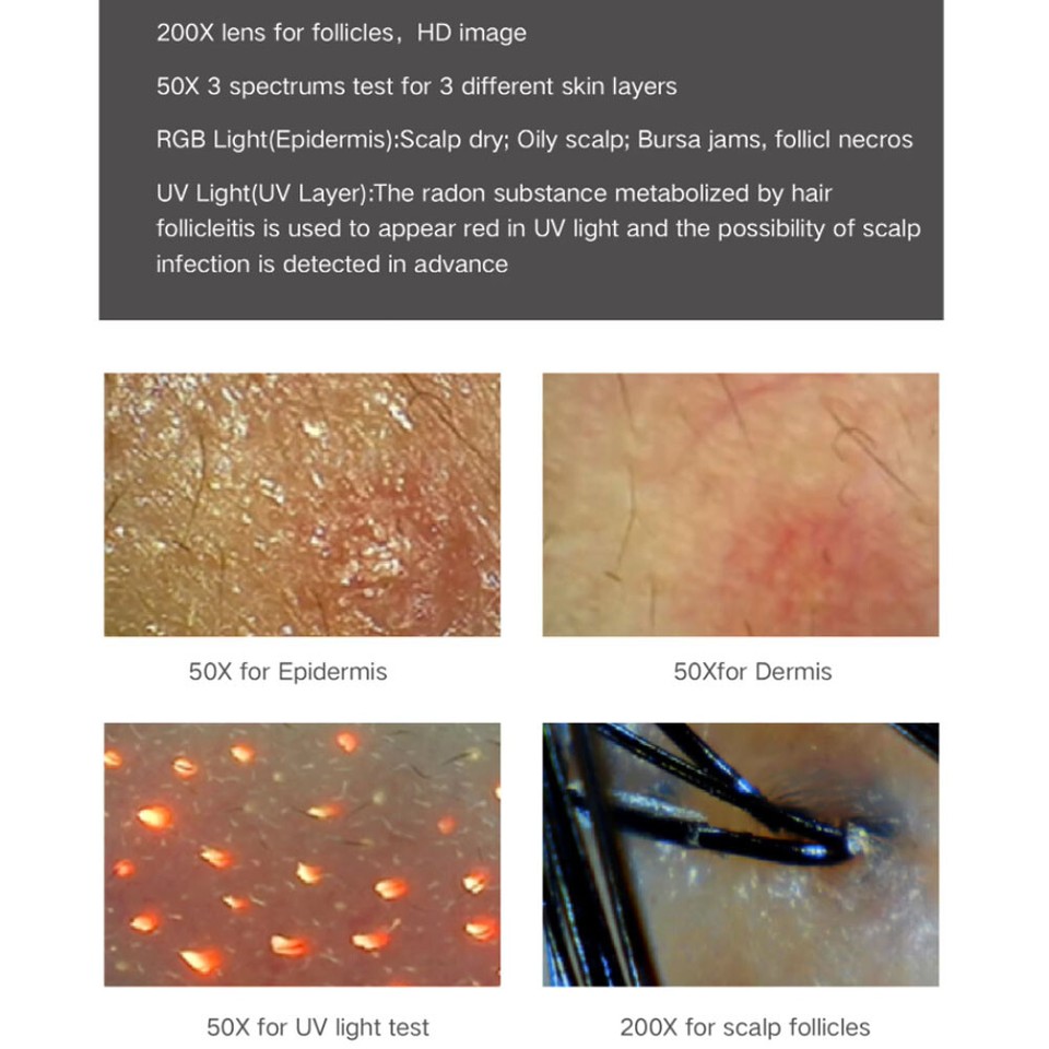 Skin Analyzer Facial Analyser Scanner Equipment Skin & Hair Analyzer ...