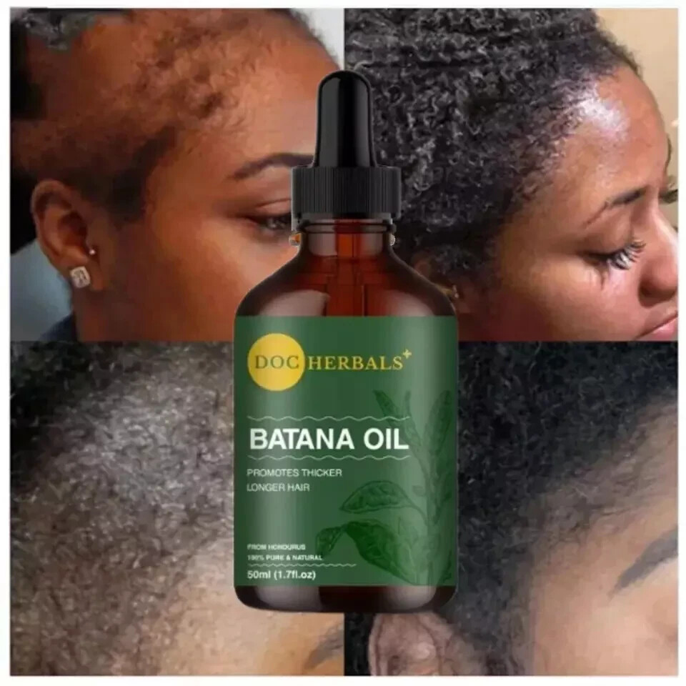 100% Pure Raw Botana Oil for Hair Growth Dr. Sebi Batana Oil from ...