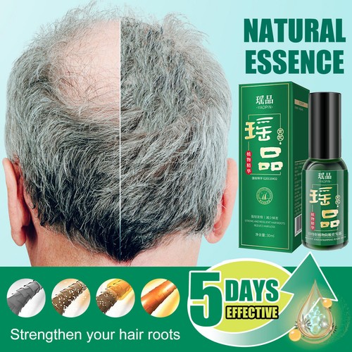 Yaopin Anti-Hair Loss & Hair Growth Solution Loss Care Liquid ...