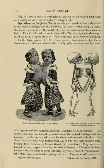 Human Deformities Pictures