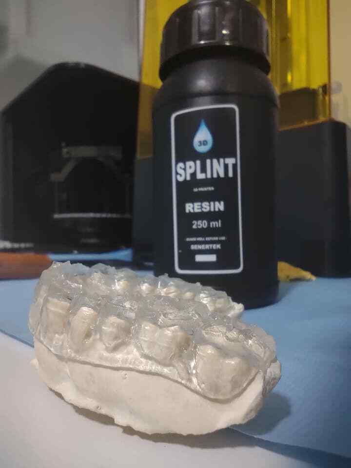 DLP SLA LCD 3d printer SPLINT resin for manufacturing splints | eBay