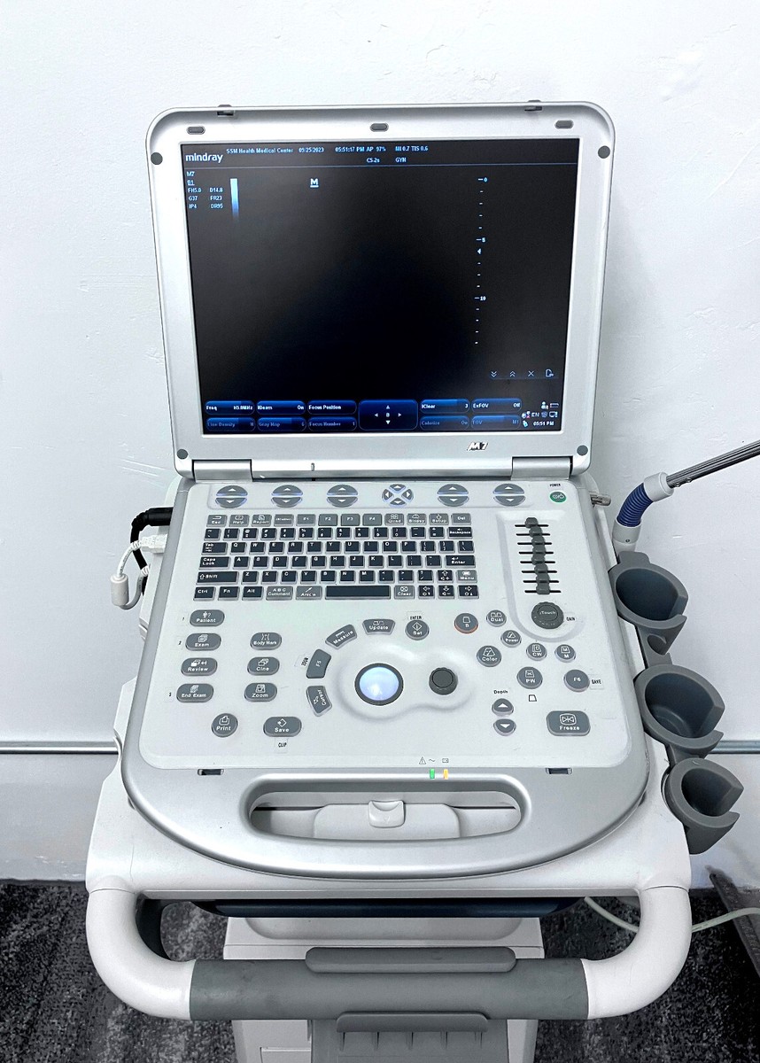 Portable Ultrasound Machine