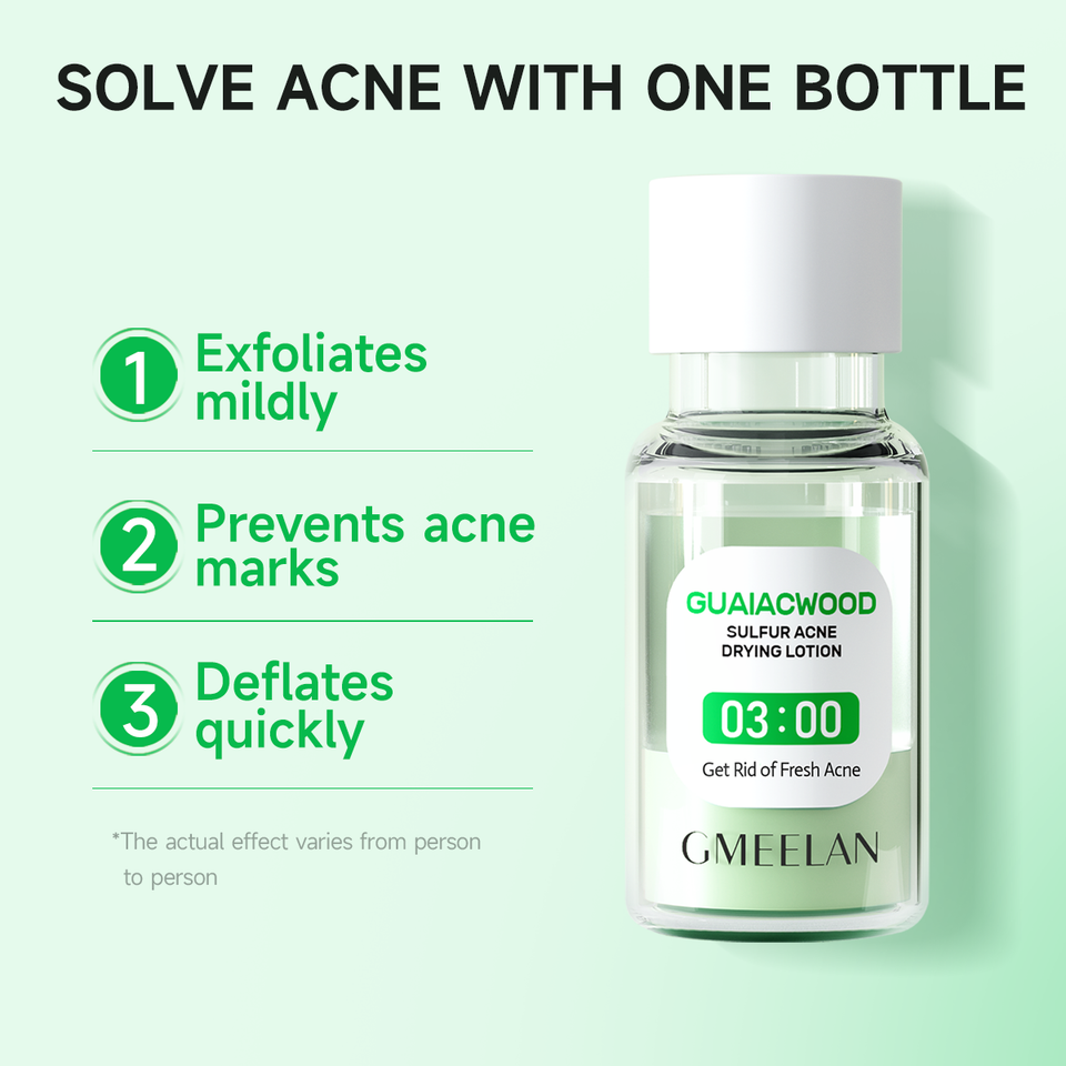 GMEELAN Guaiacwood (EXP08/2026) Sulfur Acne Drying Lotion Colloidal ...