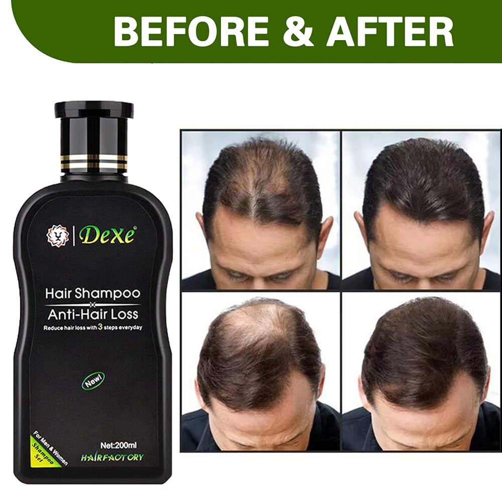 DEXE Hair Growth Shampoo Hair Regrowth Treatment Anti-Hair Loss Shampoo ...