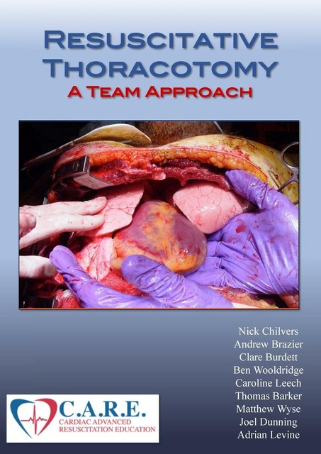 Resuscitative Thoracotomy von Nicholas Chilvers (2021, Taschenbuch ...