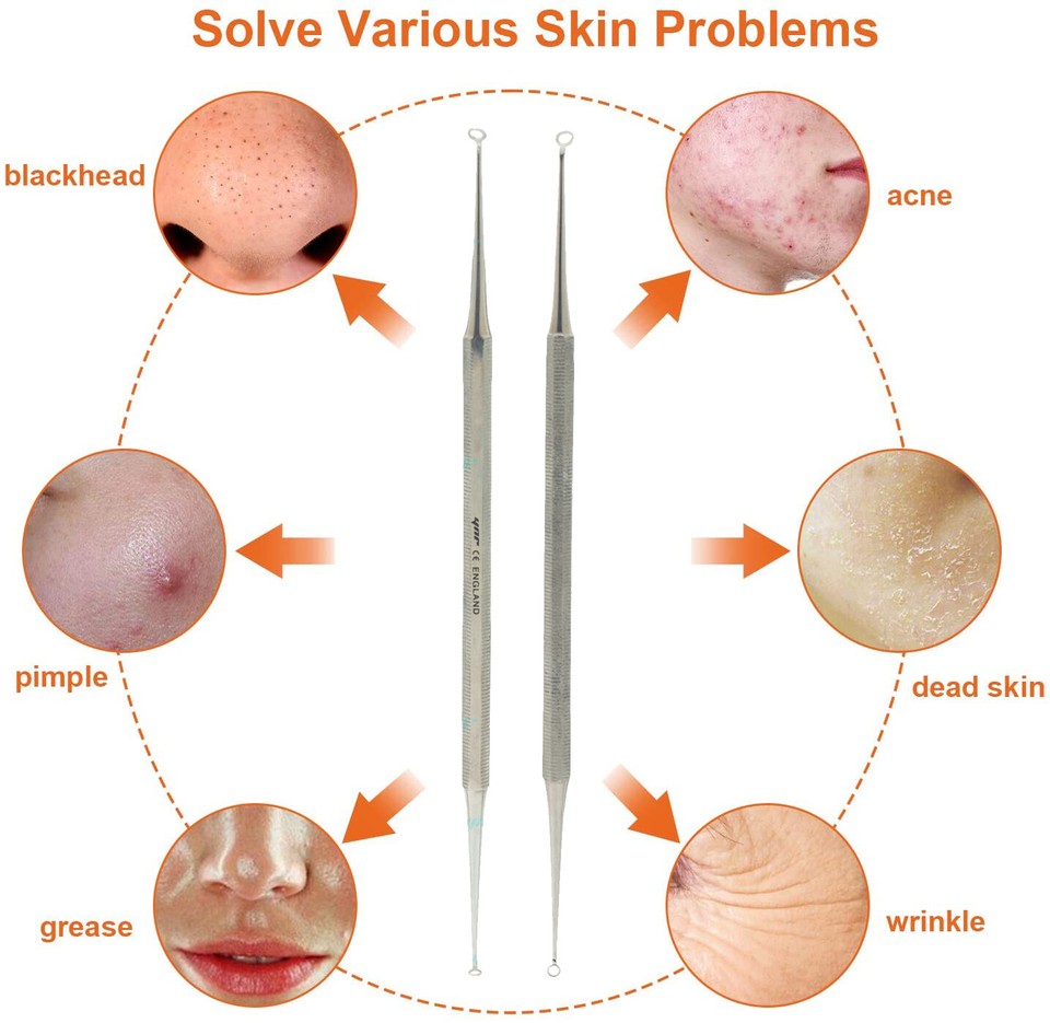 Blackhead Remover Tool Whitehead Pimple Extractor Acne Comedone Spot ...