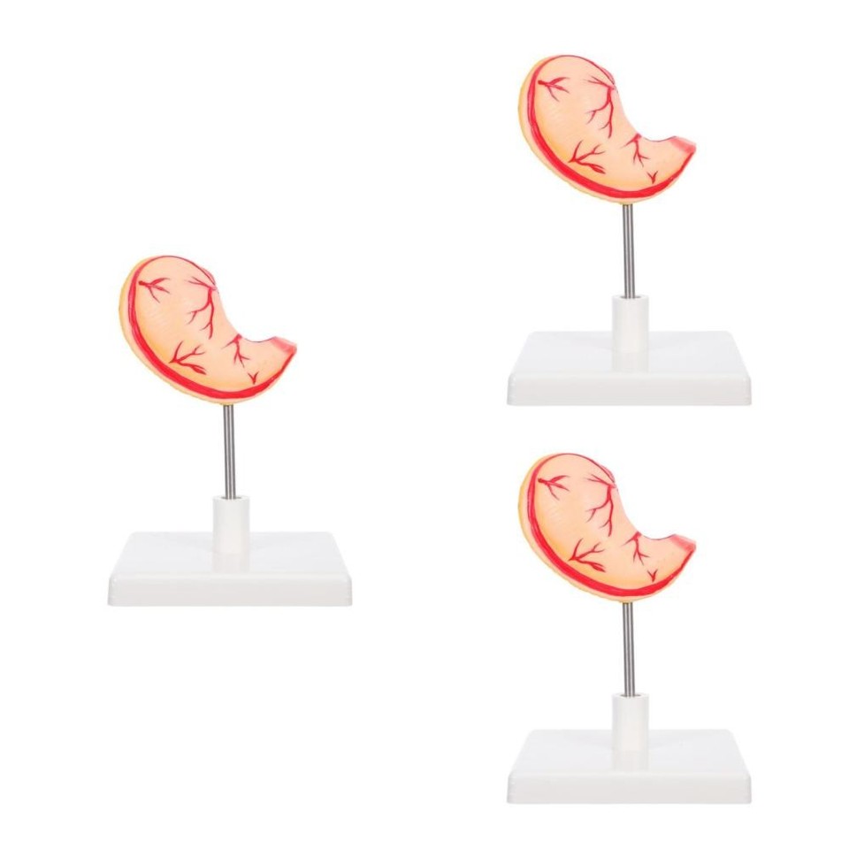 Stomach Study Model Science Education Medical Human Organ Models | eBay