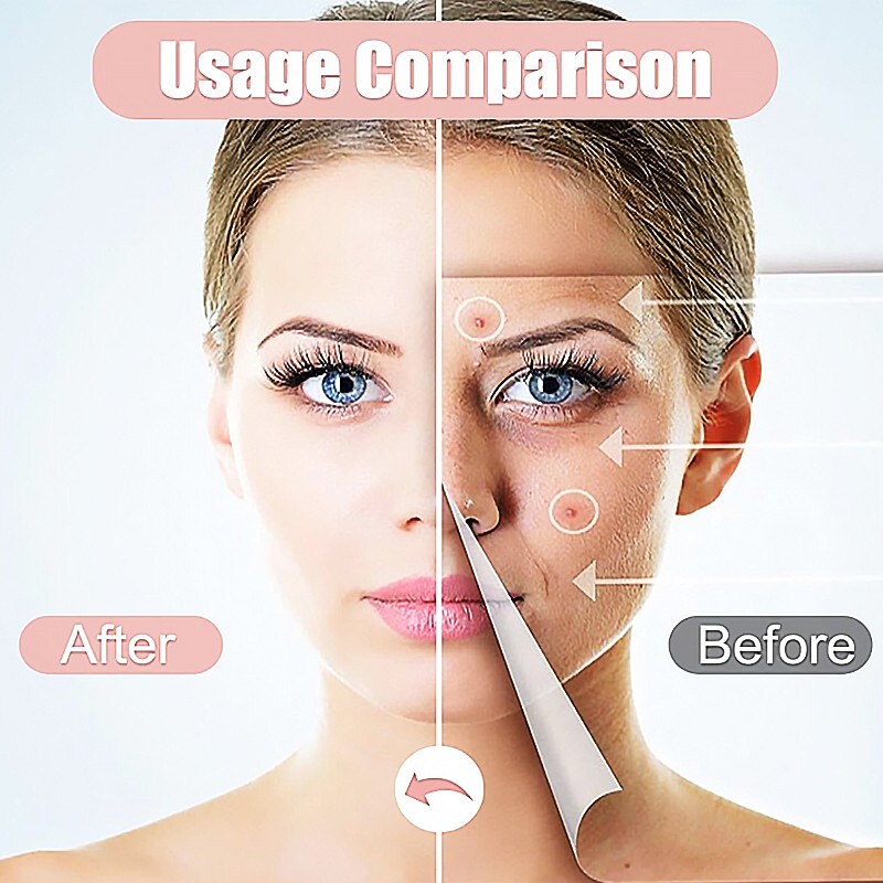 432Pc Acne Dots, Hydrocolloid Pimple Patches, Cystic Acne Patch, FACE ...