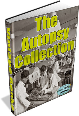 AUTOPSY COLLECTION - 50 RARE BOOKS ON DVD - post mortem,pathology,death ...