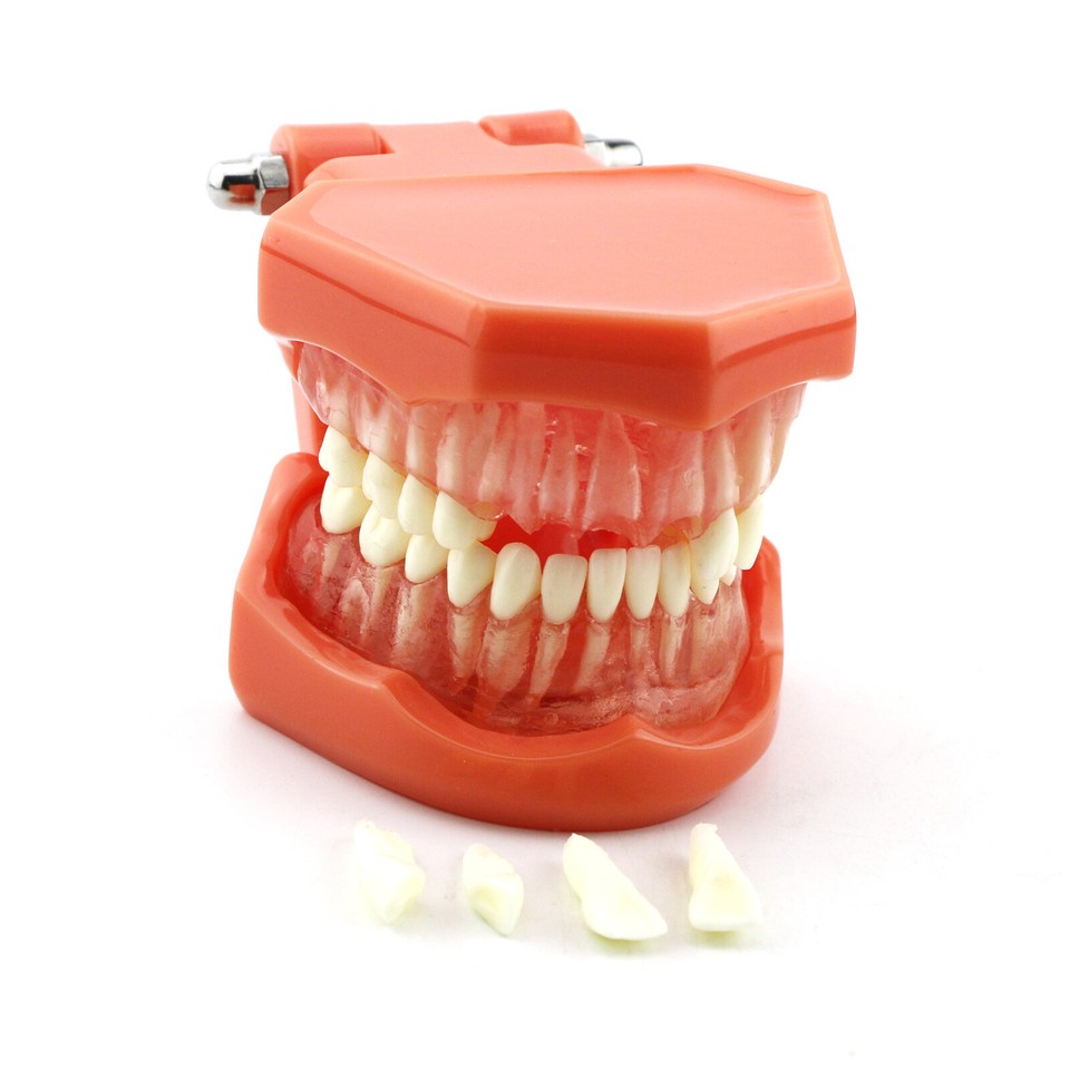 Multi Types Dental Typodont Teeth Model Implant Pathological Perio ...