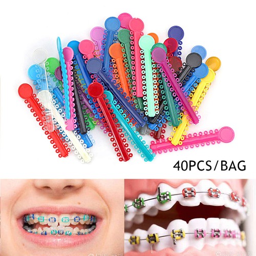 Dental Orthodontic Braces Elastic Teeth O-Ring Ligature V-Ties Rubber ...