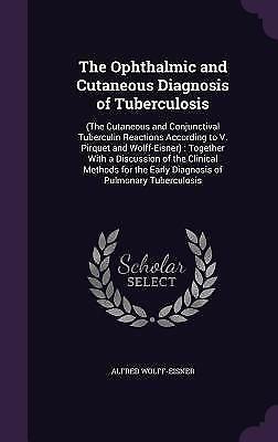 Ophthalmic and Cutaneous Diagnosis of Tuberculosis : (the Cutaneous and ...