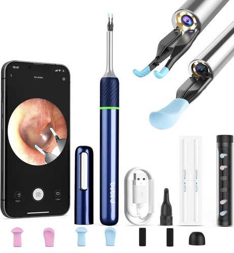 BEBIRD Note 5 Ear Wax Removal with Tweezers HD Otoscope & LED Light ...