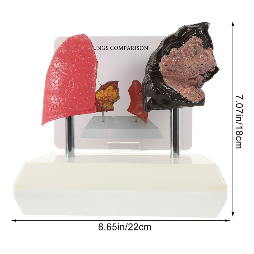 Lung Function Demonstration Model Human Lung Model 3D Lung Model | eBay