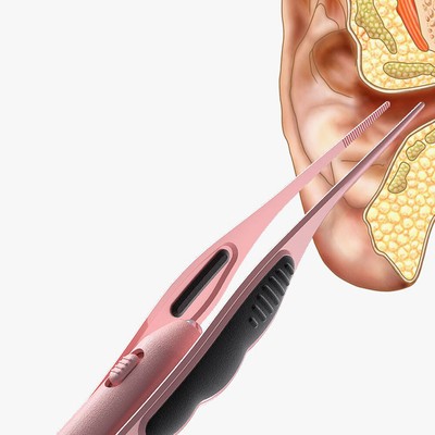 Cleaning Cerumen Cleaner Ear Wax Remover Ear Care Tools Luminous Ear ...