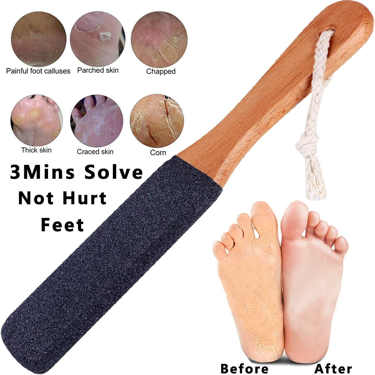 Pumic Stones for Feet Lava Pumice Stone Foot File Pumice Stone for ...
