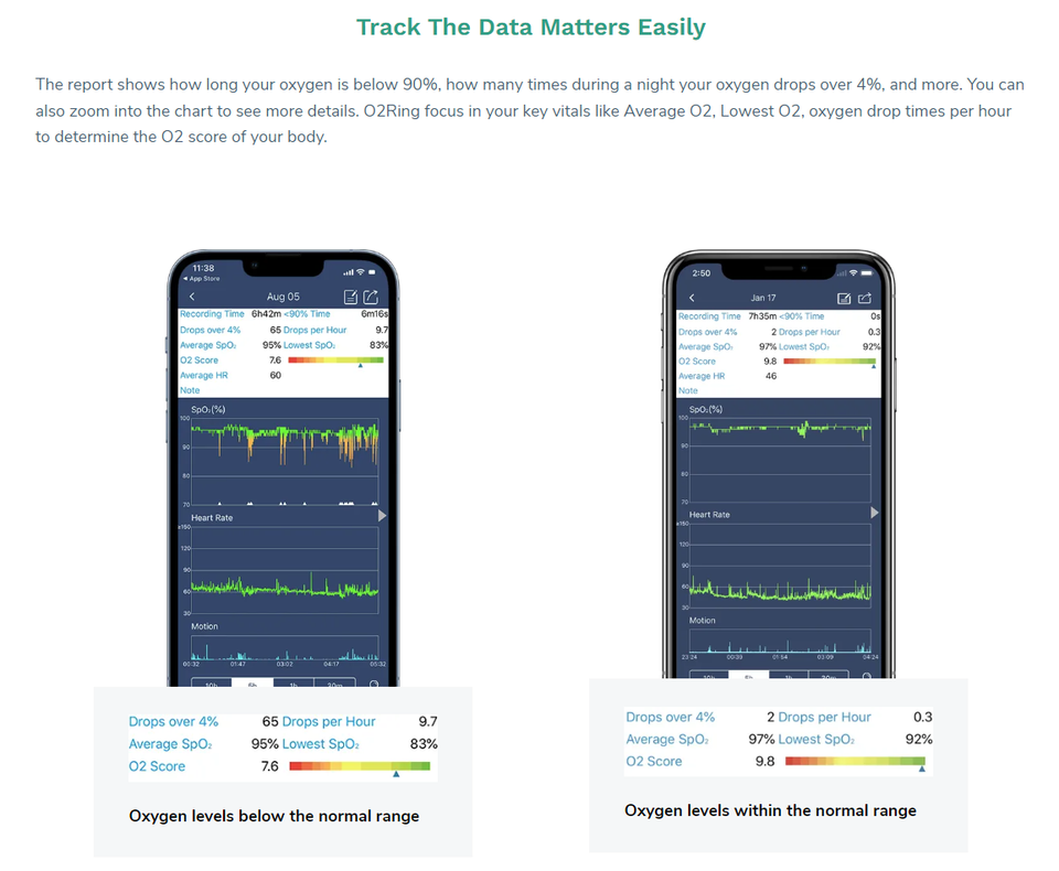 Wellue O2Ring™ Wearable Ring Oxygen Monitor-Sleep with Peace of Mind | eBay