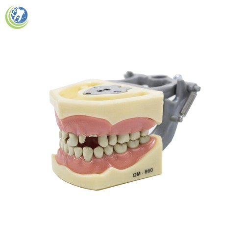 Dental Typodont Model 860R Prep Teeth NBDE NERB ADEX G V Black ...
