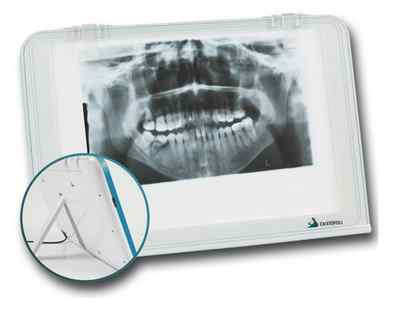 Dental Imaging & X-Ray - Xray Viewer