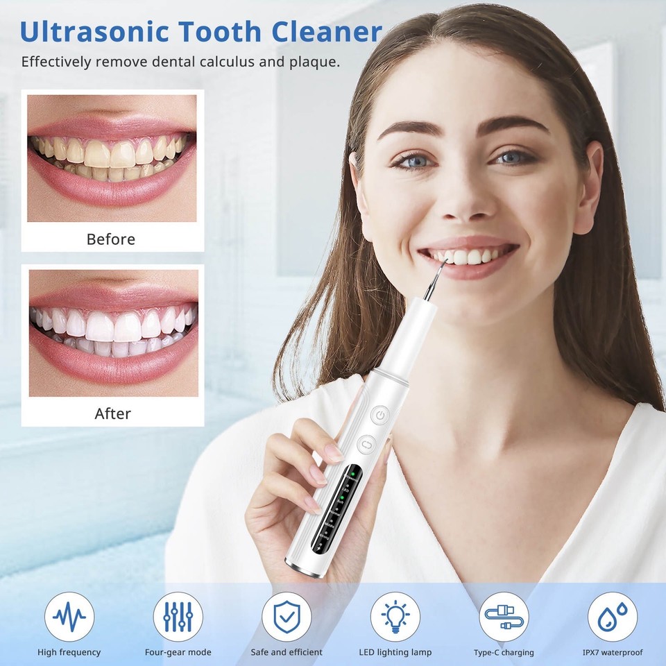 Ultrasonic Tooth Cleaner Tartar Plaque Remover Electric Dental Whiten ...