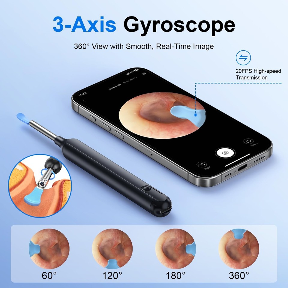 Earwax Camera Ear Camera Otoscope Cleaner, Oxbird 1080P Wireless Ear ...