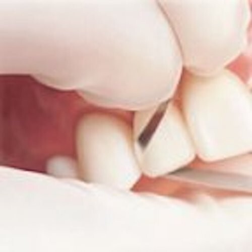 DENTAL DIAMOND STRIPS FOR INTERPROXIMAL REDUCTION IPR STRIP MEDIUM ...