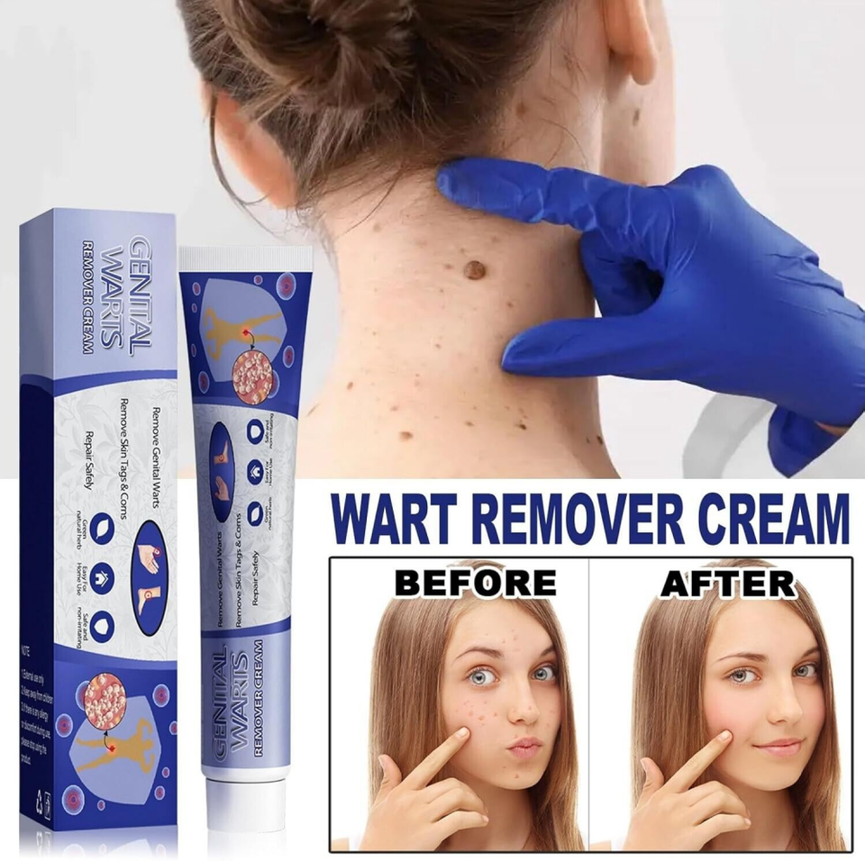Skin Tag Mole Wart Remover Removal Cream Ointment Fast Safe Natural ...
