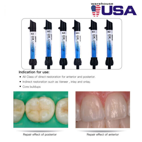 Dental DX.Universal Light Cure Composite Resin Core Buildup A3,A3.5,B1 ...