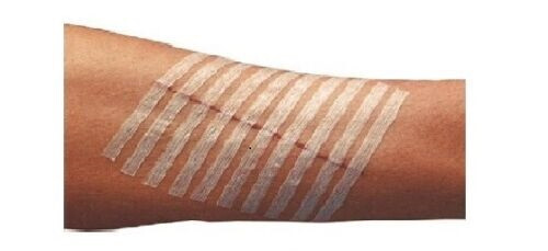 25 PACKS 3M Steri-Strip Reinforced Skin Wound Closures Strips R1547 ...