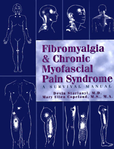 Fibromyalgia Chronic Myofascial Pain Syndrome : A Survival Manual ...