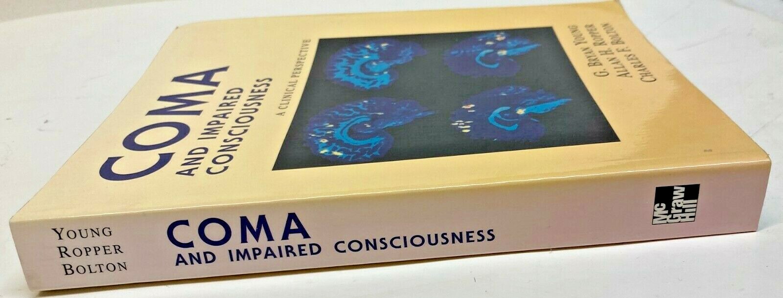 Coma and Impaired Consciousness: a Clinical Perspective by Charles F ...