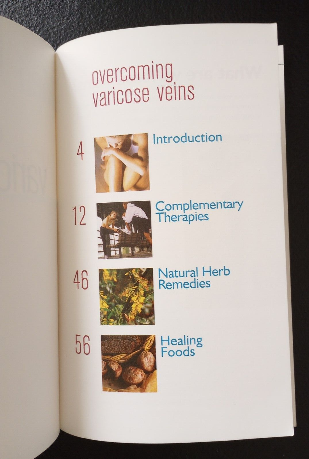 Med+Express+Overcoming+Varicose+Veins+by+Trident+Reference+Publishing ...