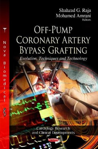Mohamed Amrani Off-Pump Coronary Artery Bypass Grafting (Hardback) (UK ...