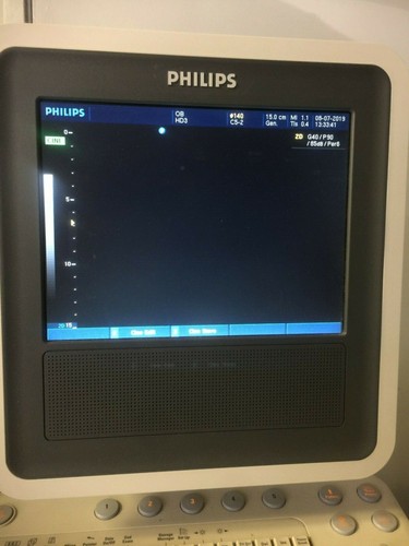 Philips HD3 Ultrasound OB/GYN, Rev 2.01 DOM 10/2010 Box Only | eBay