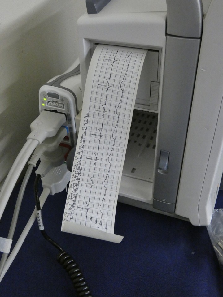 GE B650 Patient Monitor with PDM, Patient Ready -ECG-NIBP-SPO2-Biomed ...